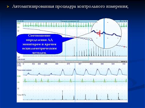 Регистратор «КАРДИОТЕХНИКА-04-АД-1» - «ИНКАРТ»
