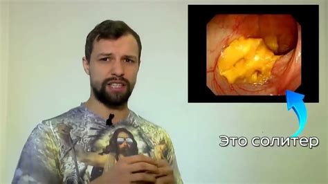 10 странных способов похудеть - YouTube