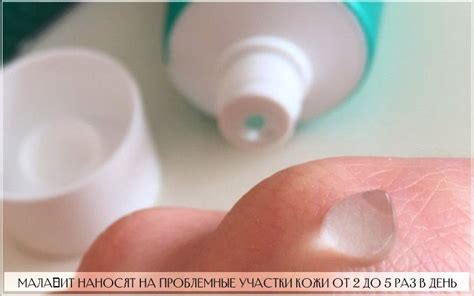 Малавит крем-гель: официальная инструкция по применению, цена ...