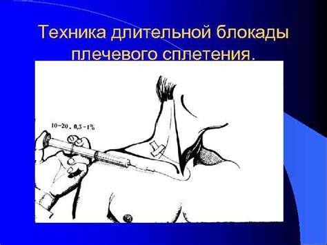 ОБЕЗБОЛИВАНИЕ ПОСЛЕ ТРАВМ И ОПЕРАЦИЙ Сергей Семёнович Копёнкин
