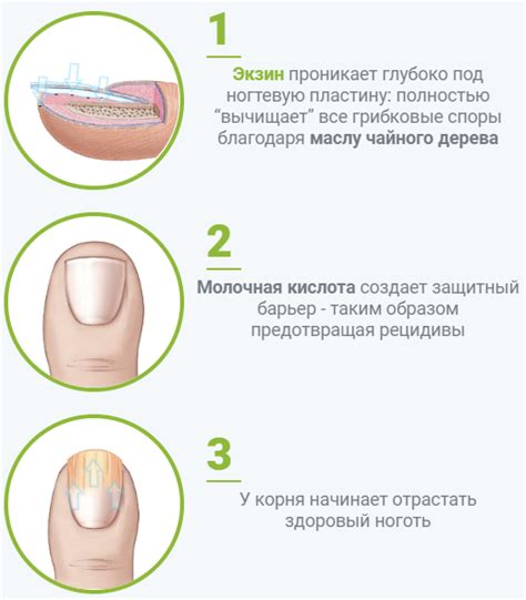 Экзин цена средства против грибка – купить в аптеке