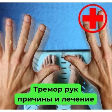 Тремор рук: причины и лечение тремора рук у взрослых и детей