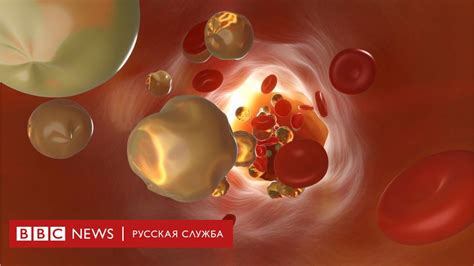 Два укола в год понизят холестерин: в Англии рекомендовали препарат ...