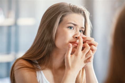Черные точки на лице: причины появления комедонов, как убрать черные ...