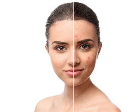 Dermatology Clinic in Abu Dhabi | Best Dermatologist | Botox