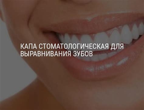 Капа для выравнивания зубов стоматологическая, как выровнять зубы элайнером