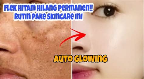 Inilah Produk Terbaik Skincare Wardah Untuk Menghilangkan Flek Hitam di ...
