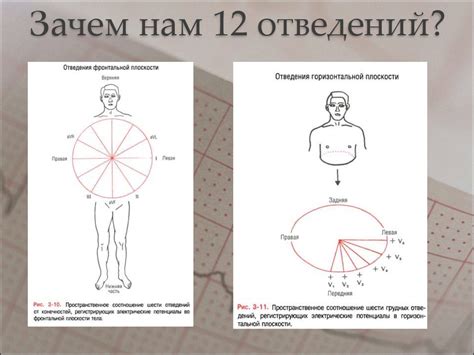 Основы ЭКГ - презентация онлайн