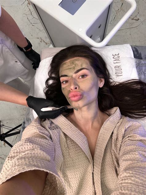 Аппаратная косметология для лица и тела – клиника Your Face Clinic в ...