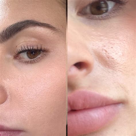 Аппаратная косметология для лица и тела – клиника Your Face Clinic в ...