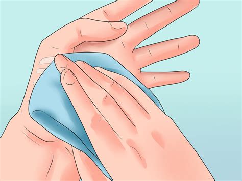 Steri Strips aufkleben: 14 Schritte (mit Bildern) – wikiHow