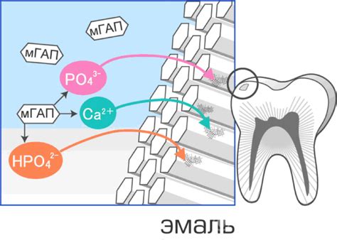 Реминерализация эмали зубов | Гель для реминерализации эмали