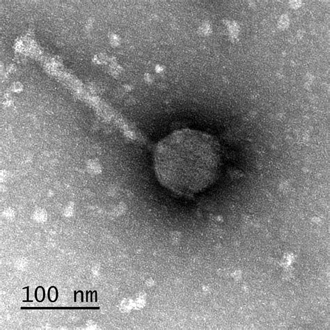 Bacillus Phage Database | Detail for Phage Kioshi