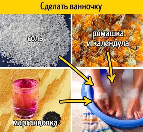 Как легко избавиться от мозоли - Образованная Сова