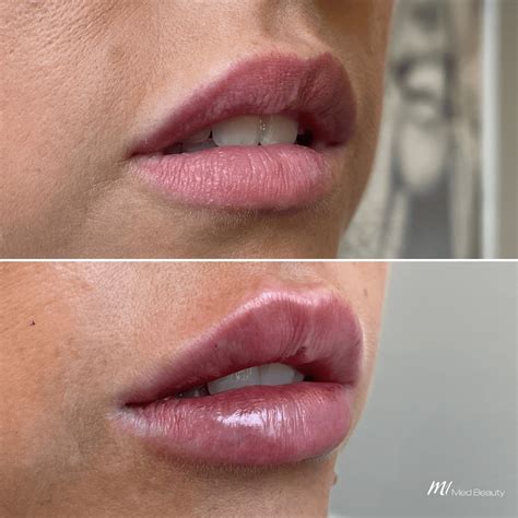 M1 Med Beauty София - M1 Med Beauty BG