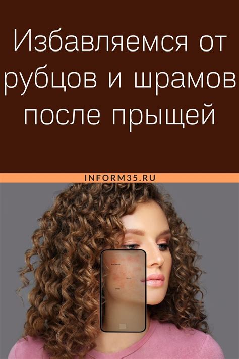 Методы и средства избавления от рубцов и шрамов, после прыщей в 2020 г ...