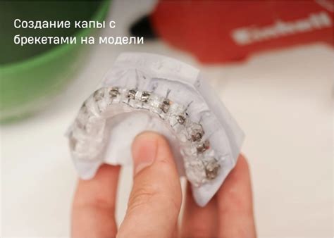 Цифровая трансформация процесса фиксации брекет-системы / Хабр