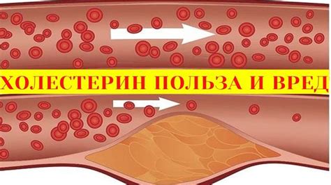 Польза и вред холестерина Питание при высоком холестерине - YouTube