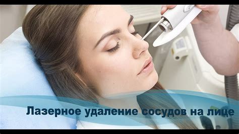 Удаление сосудов на лице лазером в клинике "Медицина и Красота на ...