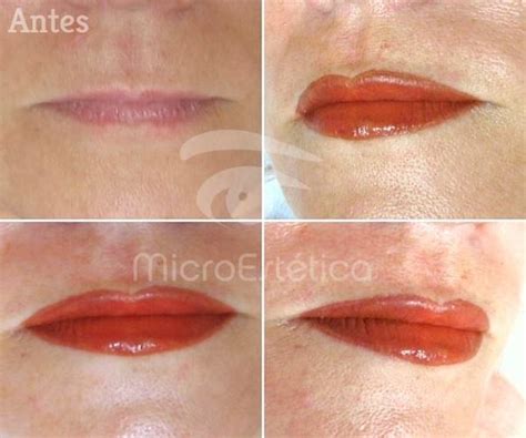 MicroEstética - Define y aumenta el volumen de tus labios... | Facebook