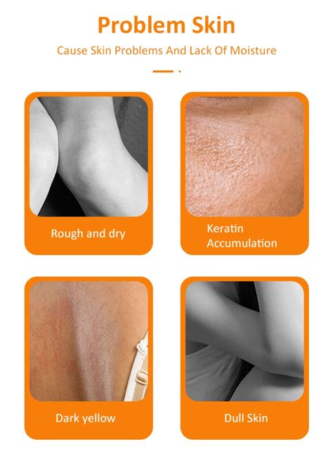 MOOYAM Removing Dead Skin Face Body Orange Peeling Lotion - 100ml ...