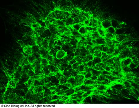 CCR1 Antibodies / Anti-CCR1 | Sino Biological