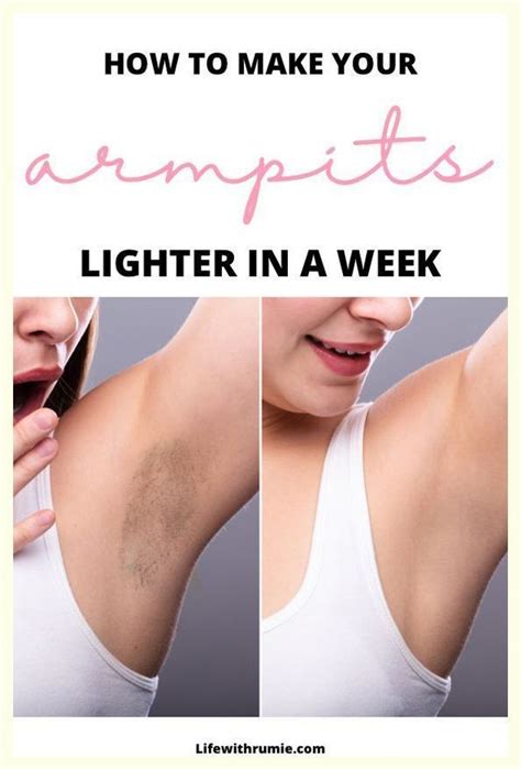 How To Whiten Underarms Fast and Naturally | How to whiten underarms, Dark armpits, Dark underarms