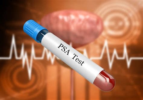 Should you get a PSA test for prostate cancer? Here's why this simple ...