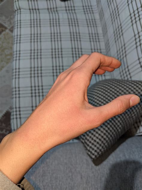 Bepanthol Derma Alerjik Reaksiyon Gösterdi - Şikayetvar