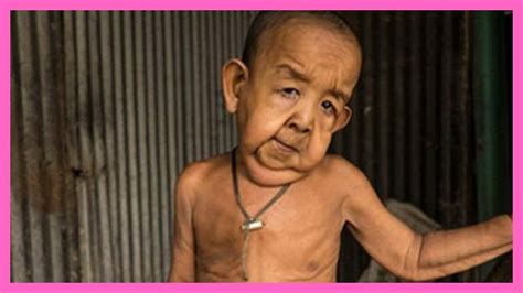 Top 10 Unusual Kids Around The World Kids With Unique Features In 2020