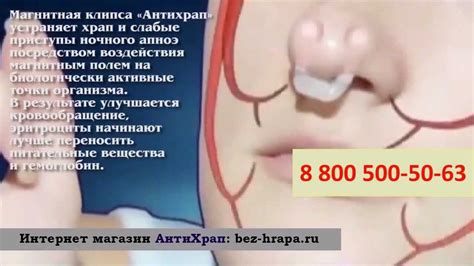 Клипсы от храпа "Антихрап" - YouTube