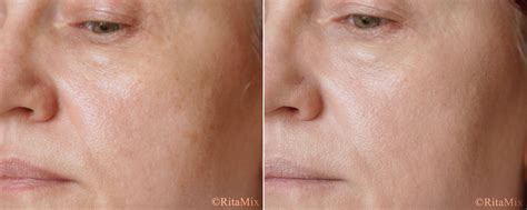 Dr. Jart+ Rejuvenating Beauty Balm Silver Label SPF 35/ PA++ ...