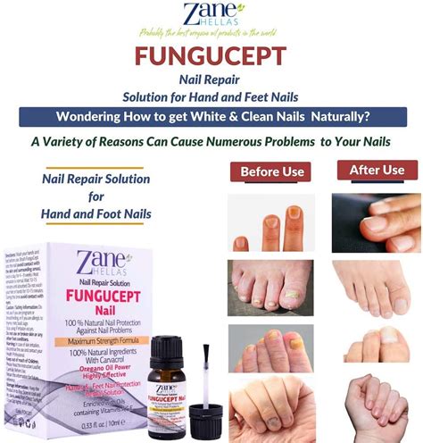 Fungucept Nail Repair Solution. Helps Nails Grow Healthy. Helps New ...