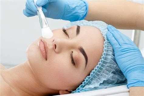 Azelaic Peel | Anti-Inflammatory Peel | Skin Renewal
