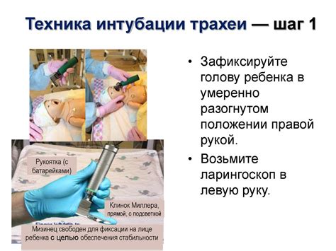 Интубация трахеи при проведении первичной реанимации новорожденных ...