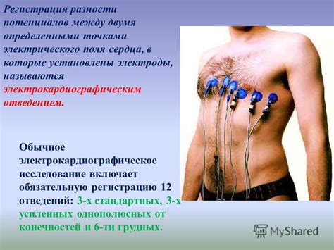 Презентация на тему: "Лекция тема: «Электрокардиография. Техника съемки ...