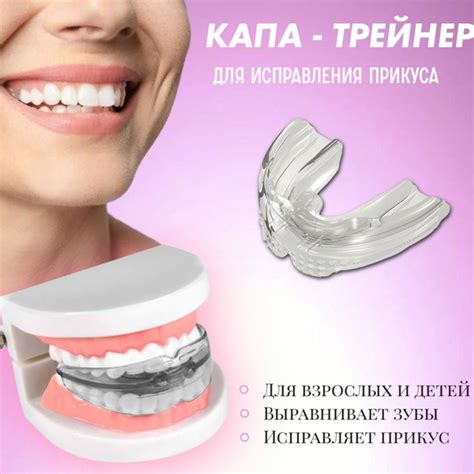 Трейнер для зубов Фаза 1 - Мягкая / капа для выравнивания зубов и ...