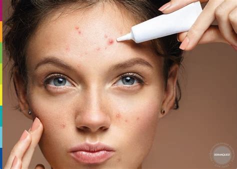 DERMAQUEST » Ретиноиды и бензоила пероксид: как использовать вместе ...