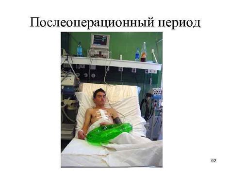 Кафедра общей хирургии УГМА Предоперационная подготовка операция ...