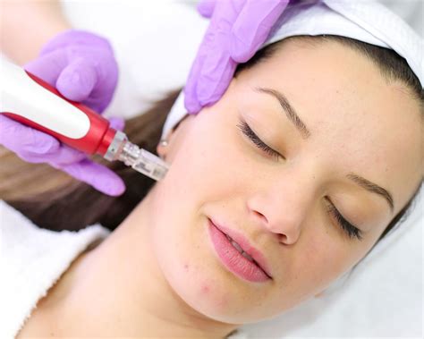 Dermapen – Beauty Art İstanbul