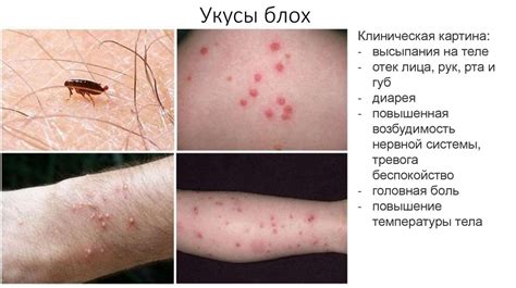 Неотложная помощь при укусах насекомых и змей - online presentation