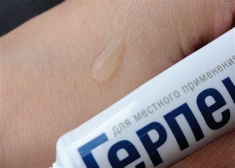 Герпенокс при герпесе: инструкция по применению, состав