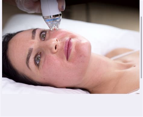 ENDYMED – революционна платформа за подмладяване | Derma Life