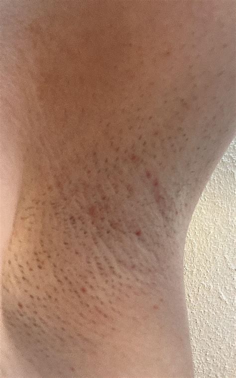 Shave or don’t shave? : r/PricklyPits