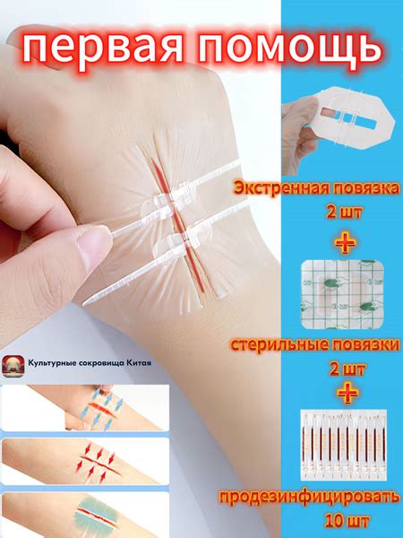 лейкопластырь медицинский;Эластичные бинты 2 шт./упаковка - купить с ...