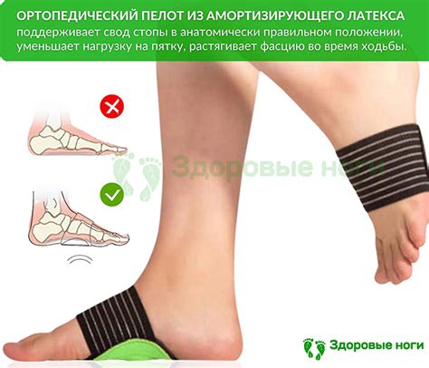 Ортопедические стельки Strutz при поперечном плоскостопии. Купить ...