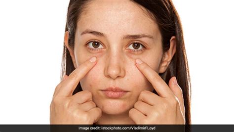 3 Krim Untuk Menghilangkan Eyebag Yang Paling Efektif