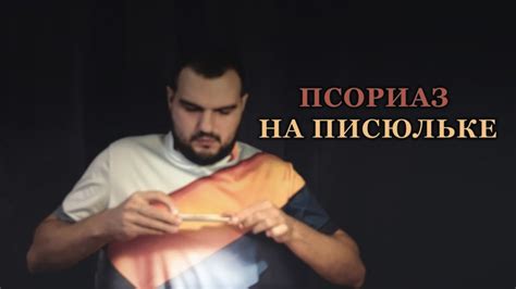 ПСОРИАЗ НА ПИСЮЛЬКЕ: 📝симптомы 📝лечение 📝стадии 📝бритьё 📝секс #PSORIK ...