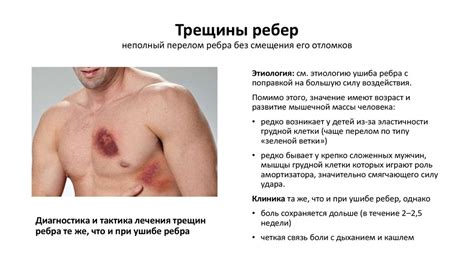 Лечение ушиба ребра