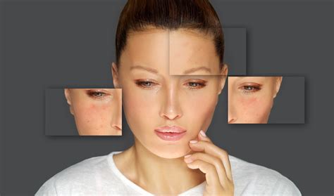 The application of Kojic Acid Chinese Factory Provide Top Quality